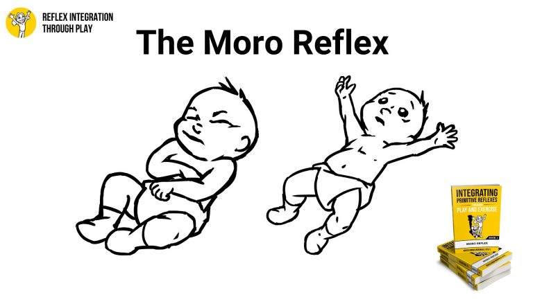 The Moro Reflex: Key to Infant Survival and Development - Reflex ...